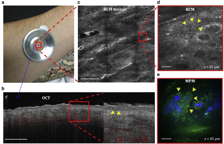 Research Techniques Made Simple: Emerging Imaging Technologies for ...